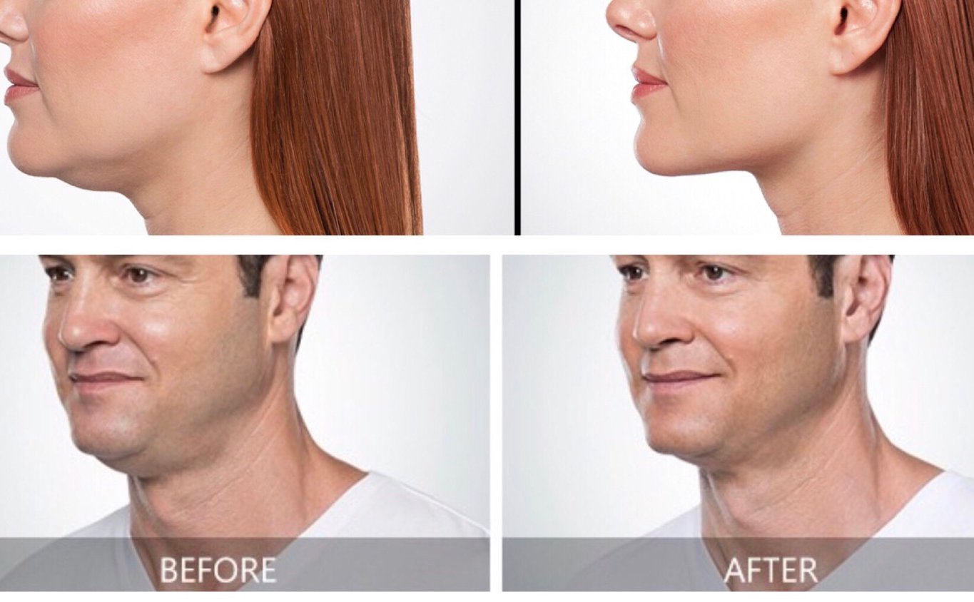 Treatments | Hayley Aesthetics